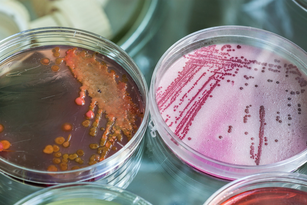 Eskape Pathogen article on Infectioncontrol.tips - UK Construction Online